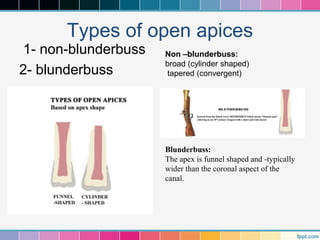 Apexogenesis & apexification | PPT