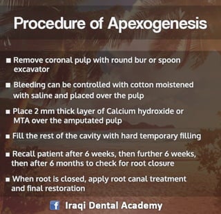 Apexogenesis Procedure - A Pediatric Lecture | PDF