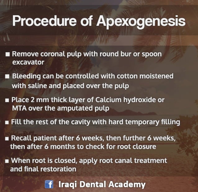 Apexogenesis Procedure - A Pediatric Lecture | PDF