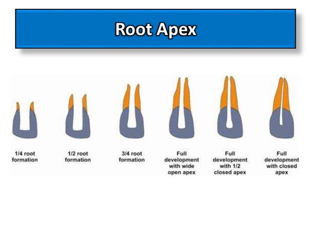 Apexogenesis and Apexification - pediatric dentistry