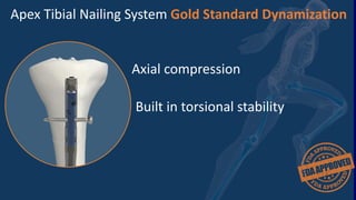 OrthoXel Apex Tibial Nailing System Summary | PDF