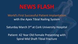 OrthoXel Apex Tibial Nailing System Summary | PDF