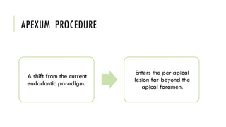 Apexum procedure in endodontics.pptx babe | PPTX