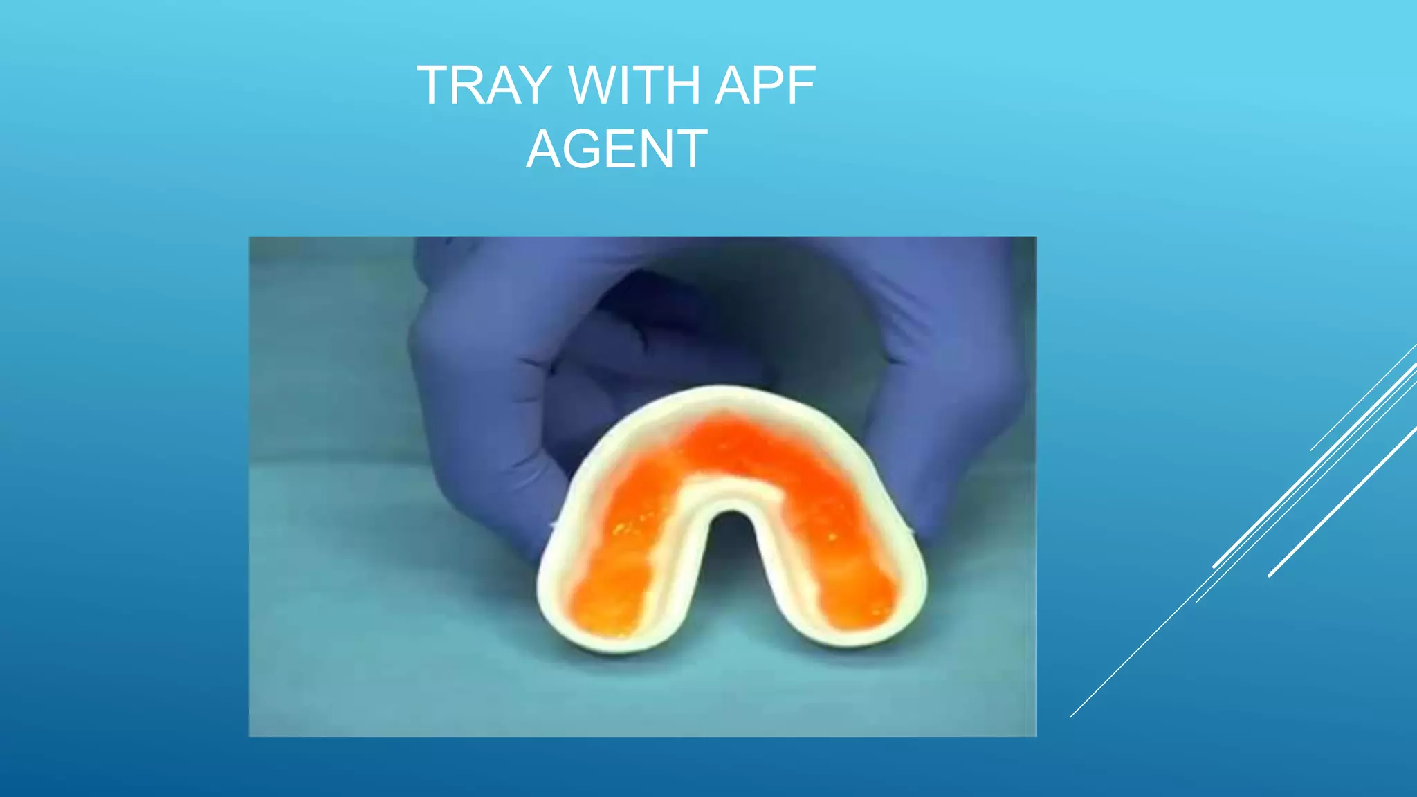 Apf acidulated phosphate fluoride | PPT