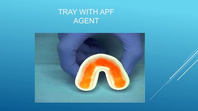 Apf acidulated phosphate fluoride | PPT
