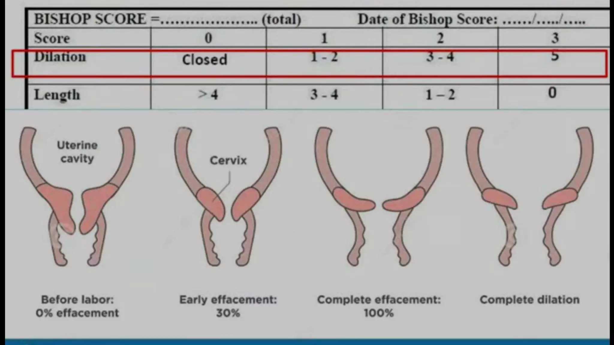 APGAR and BISHOP Scoring.pptx