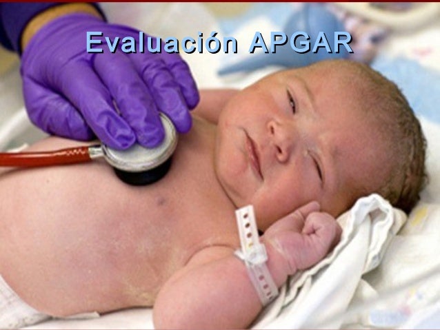 Test Apgar del Recién Nacido