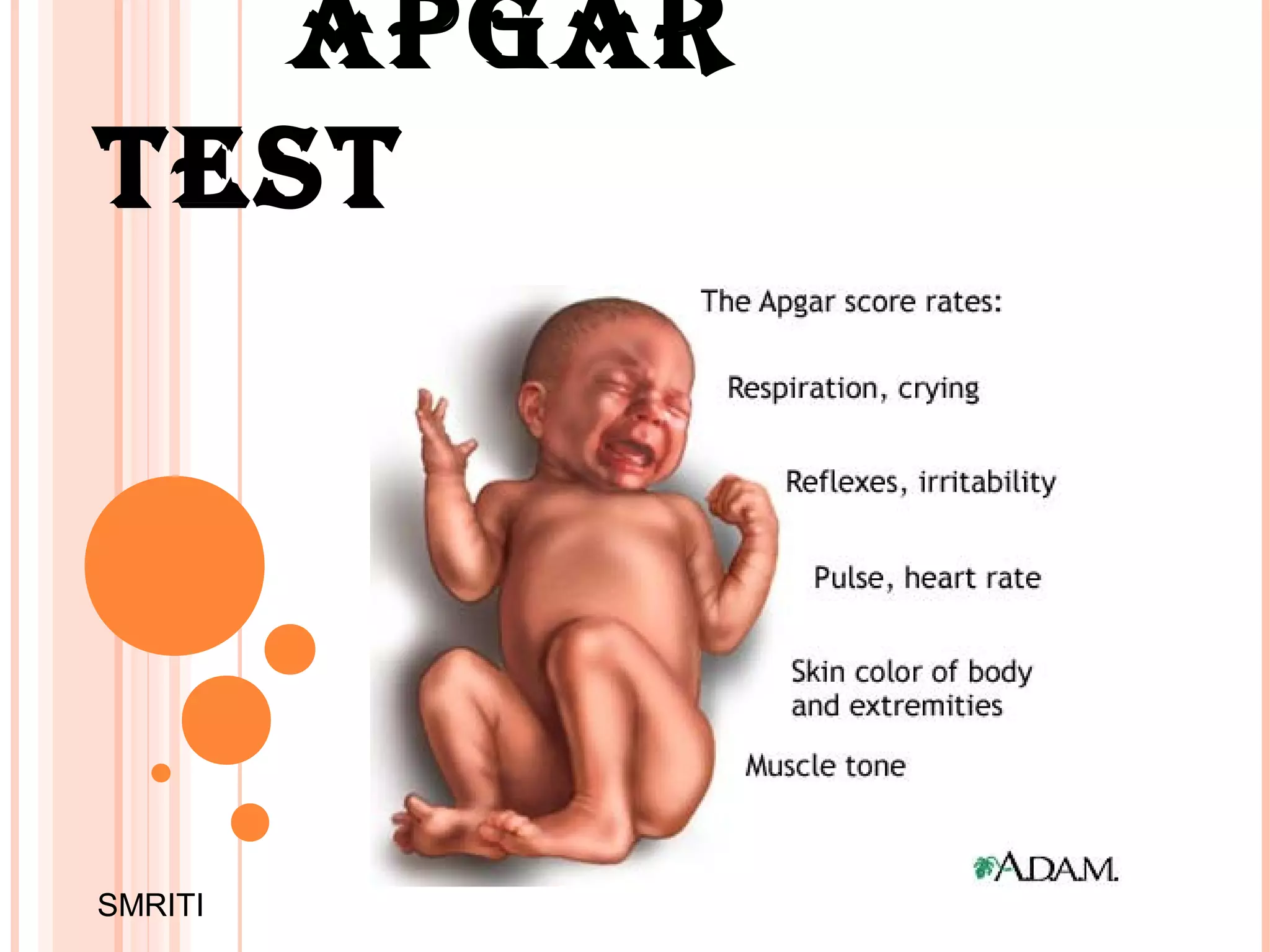Apgar score | PPT