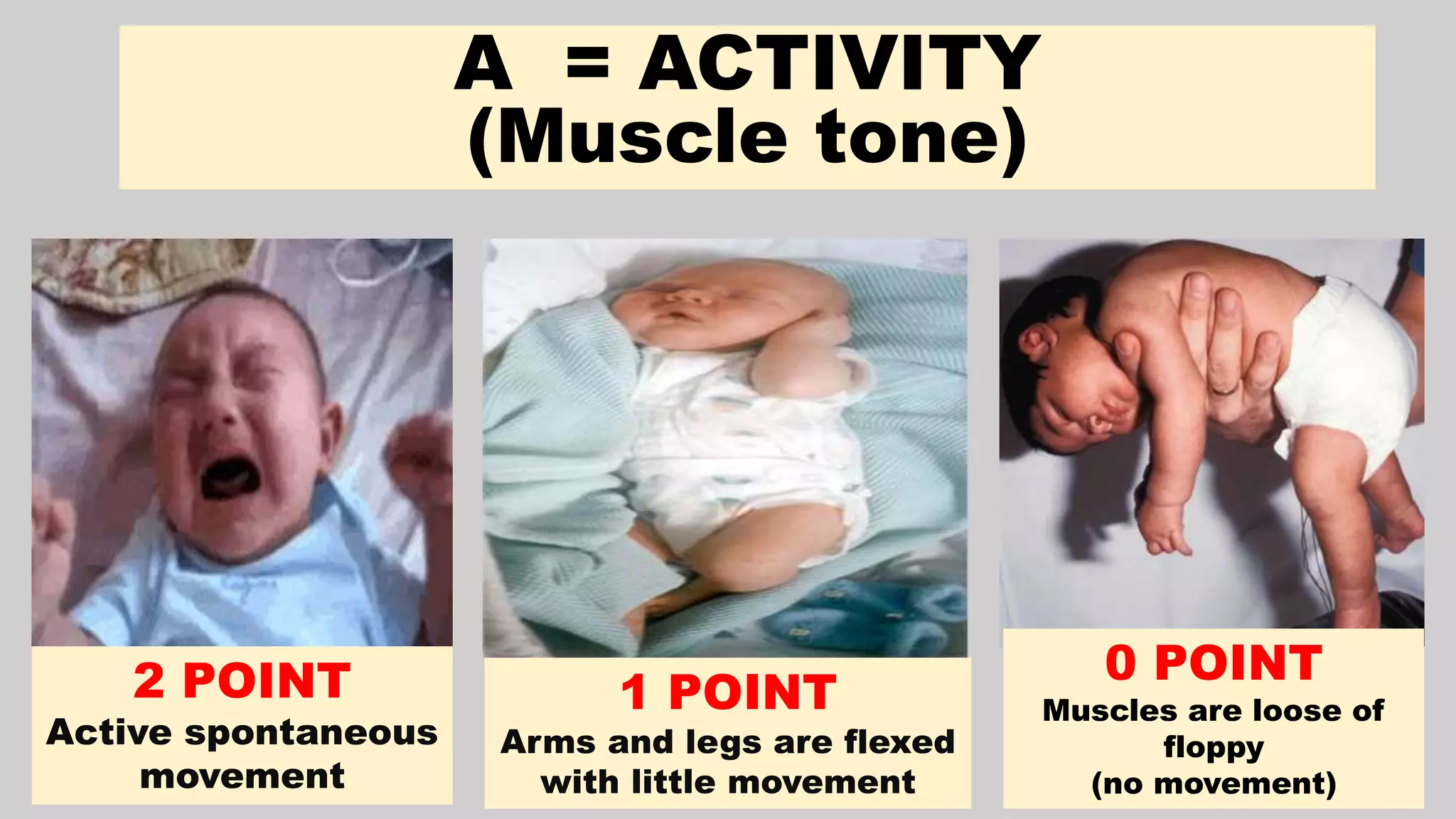 Apgar score |newborn assessment | PPTX