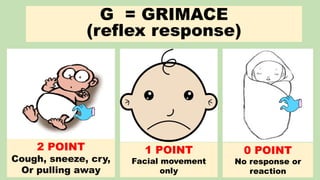 Apgar score |newborn assessment | PPTX