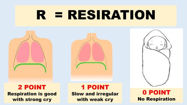 Apgar score |newborn assessment | PPTX | Children\'s Health | Healthy ...