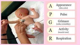 Apgar score |newborn assessment | PPTX
