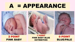 Apgar score |newborn assessment | PPTX