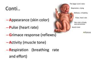 Apgar Score What Is The Apgar Score? Apgar Score Chart, 43% OFF