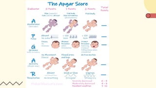 materi APGAR SCORE bayi baru lahir 2024.pptx