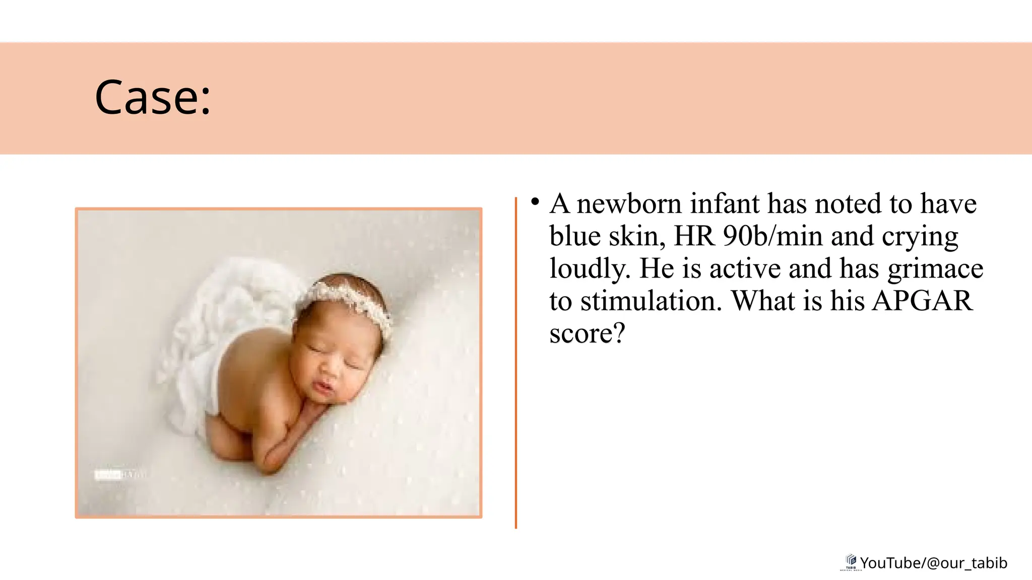 What is APGAR Score and when to assess it.pptx