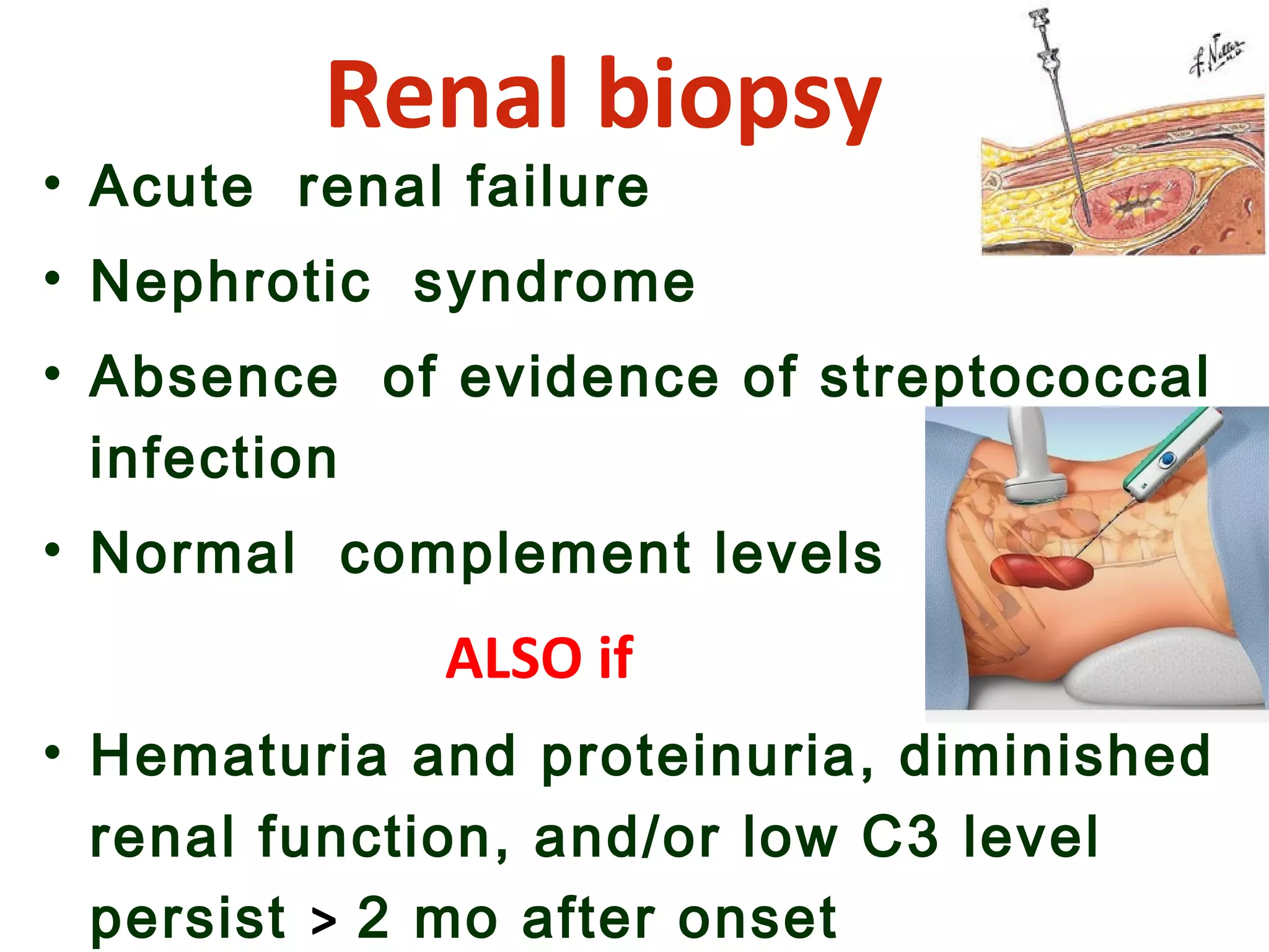 NEPHRITIC SYNDROME / APSGN IN CHILDREN | PPT