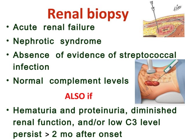 NEPHRITIC SYNDROME / APSGN IN CHILDREN | PPT