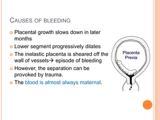 Antepartum Hemorrhage | PPTX