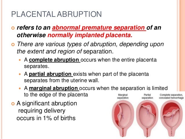 Antepartum Hemorrhage