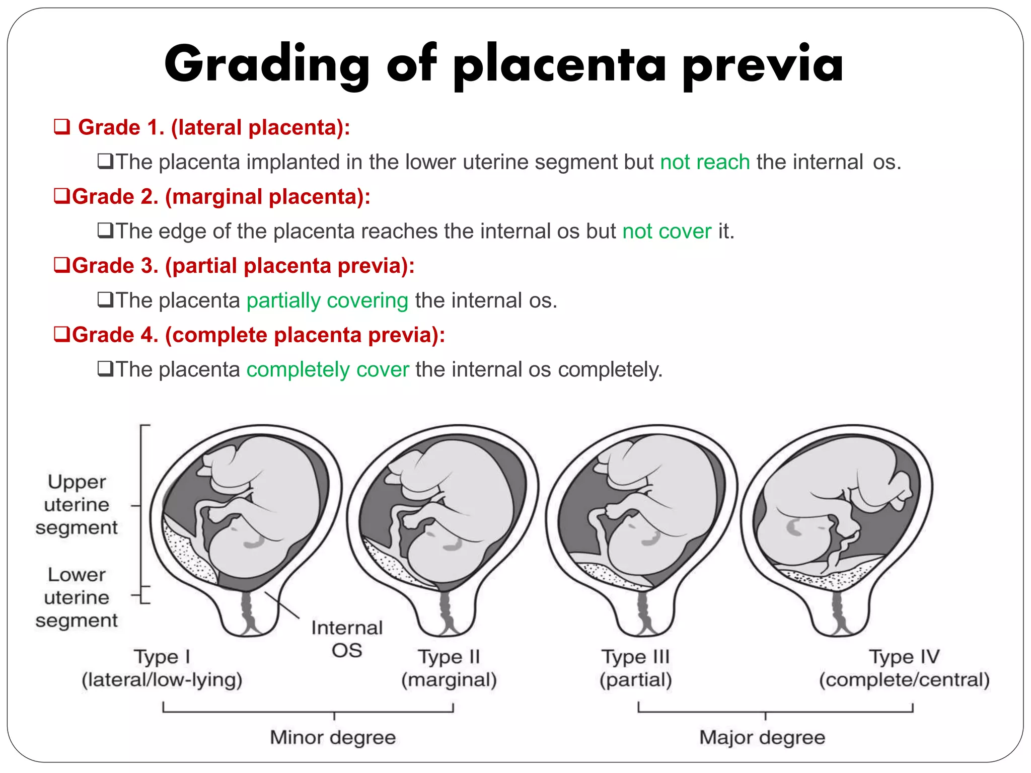 ANAESTHESIA FOR ANTEPARTUM HAEMORHHAGE | PPTX