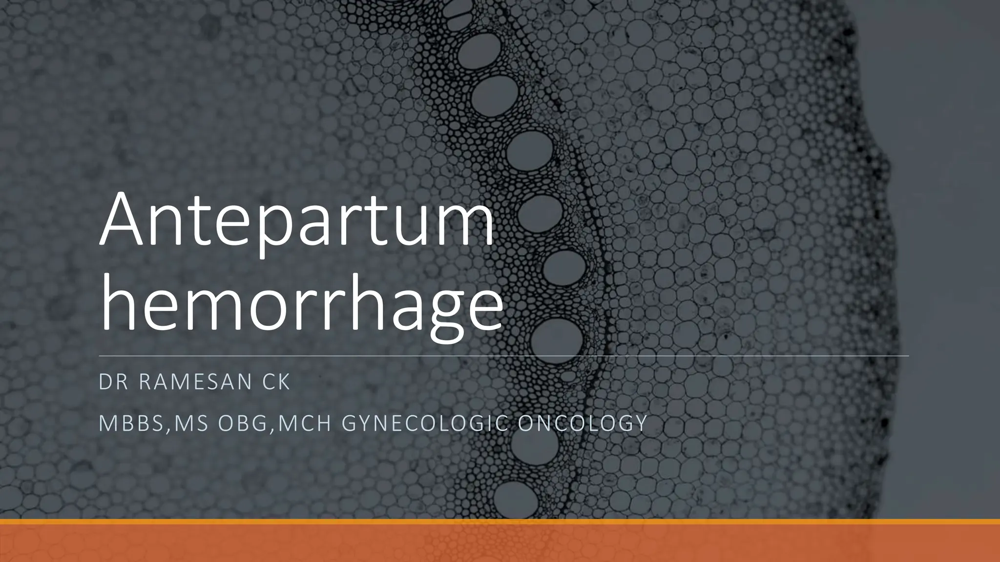 antepartum hemorrhage diagnosis and management | PPT