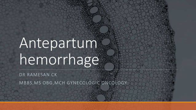 antepartum hemorrhage diagnosis and management | PPTX | Pregnancy ...
