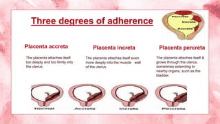 APH(Antepartum Hemorrhage)& PPH(Postpartum hemorrhage).pptx