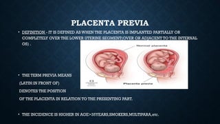 Antepartum haemorrhage - an emergency in Obstetrics | PPTX
