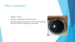 Aphakia | PPTX