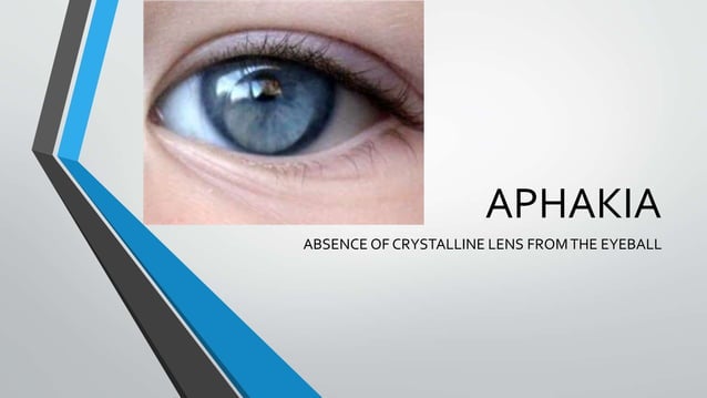 Aphakia | PPTX