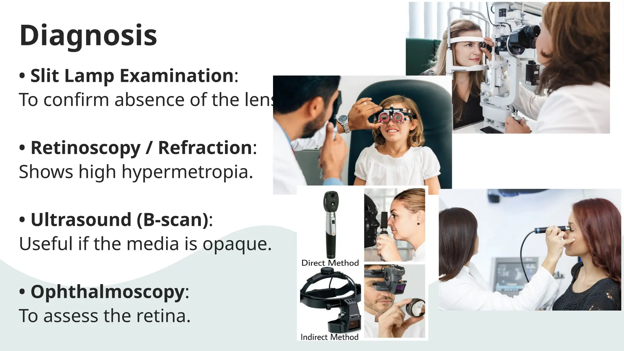 Aphakia : diagnosis, and symptoms , treatment | PPTX