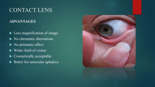 Aphakia and pseudophakia | PPTX | Eye and Vision Conditions | Diseases ...