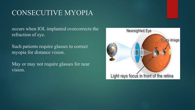 Aphakia and pseudophakia | PPTX | Eye and Vision Conditions | Diseases ...