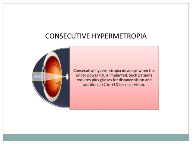 Aphakia and pseudophakia (1) | PPTX | Eye and Vision Conditions ...