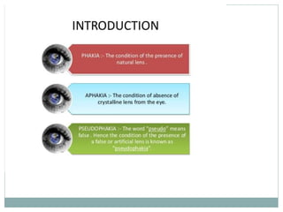 Aphakia and pseudophakia (1) | PPTX