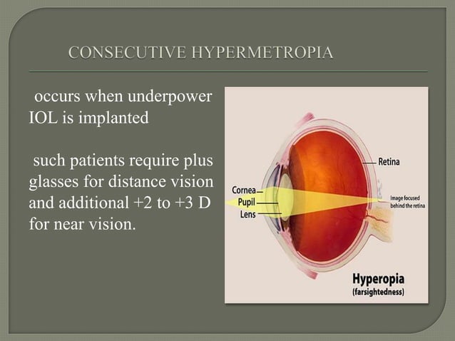 Aphakia & Pseudophakia.pptx | Eye and Vision Conditions | Diseases and ...