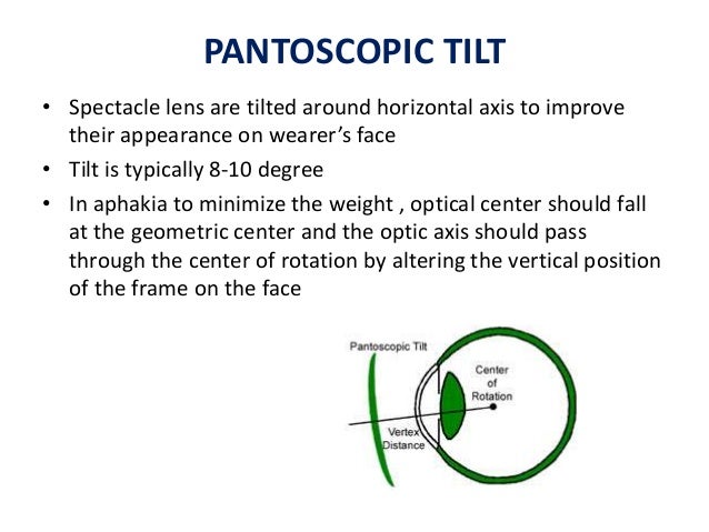 Aphakia by SURAJ CHHETRI