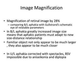 Aphakic spectacle dispensing | PDF