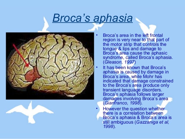 Aphasia