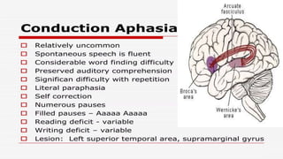 aphasia.pptx