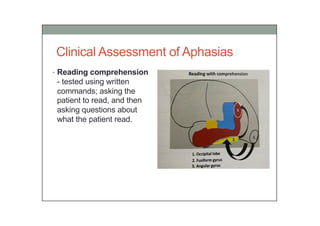 Aphasia and common aphasia syndromes.pdf