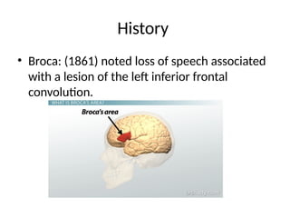 Aphasia refers to a disorder of language, including various ...