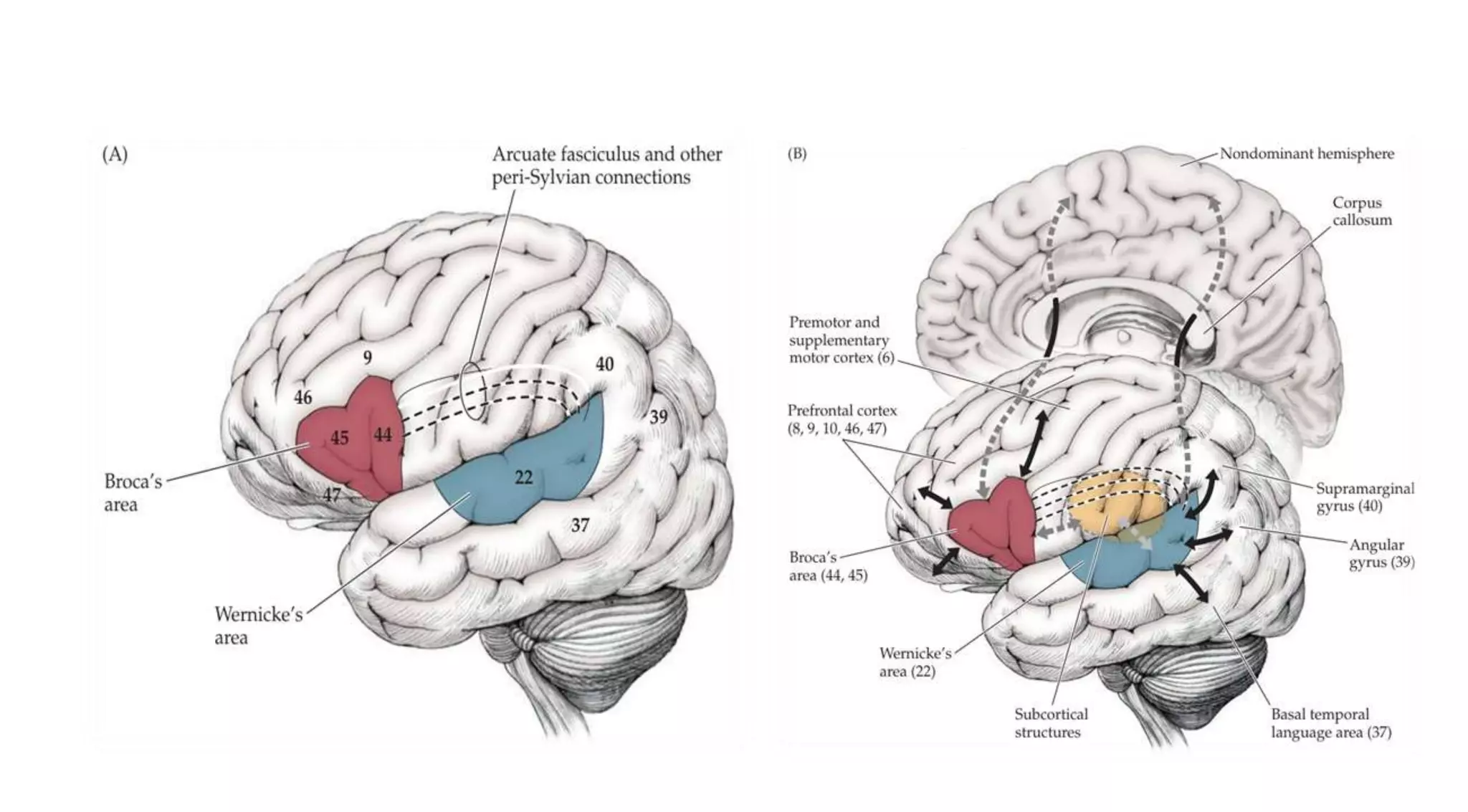 APHASIA AND DYSARTHRIA last.pptx