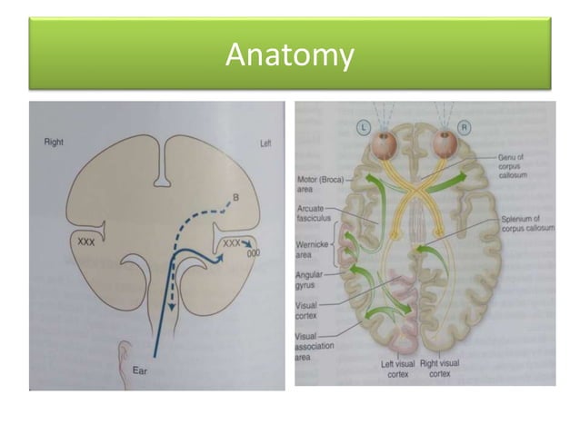 APHASIA and APHASIC SYNDROMES PRESENTATION NEUROLOGY | PPTX | Brain and ...