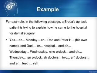 Broca's aphasia- neurolinguistics- kiran nazir | PPT