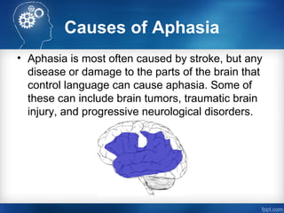 Broca's aphasia- neurolinguistics- kiran nazir | PPT