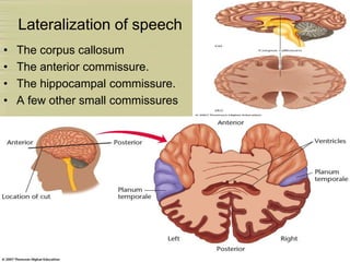 Aphasia, Laterlization Of Speech, Apraxia.pptx