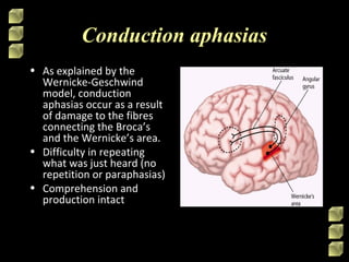 Conduction Aphasia