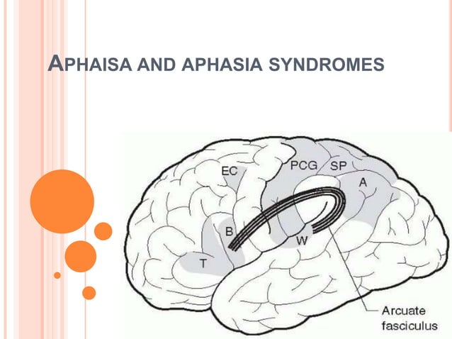Aphasia and types | PPTX | Brain and Nervous System Disorders ...